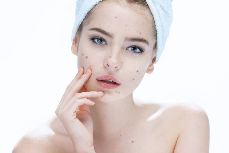 Why Are There Red Dots & Spots On My Skin? [7 Common Skin Conditions ...